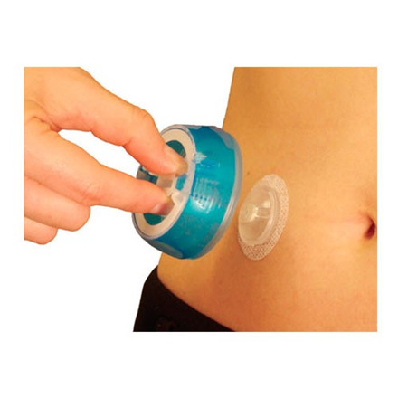 I-PORT Advai-Port Advance injektionsport 6 MM (SPR10)